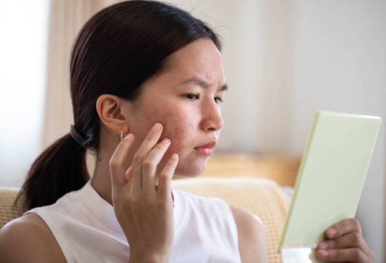 皮膚泛紅急救指南：臉部泛紅怎麼辦？8招改善9款保養品推介 - findnovelty